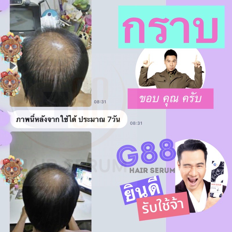 G88 hair serum Black Friday - g88_official - ThaiPick