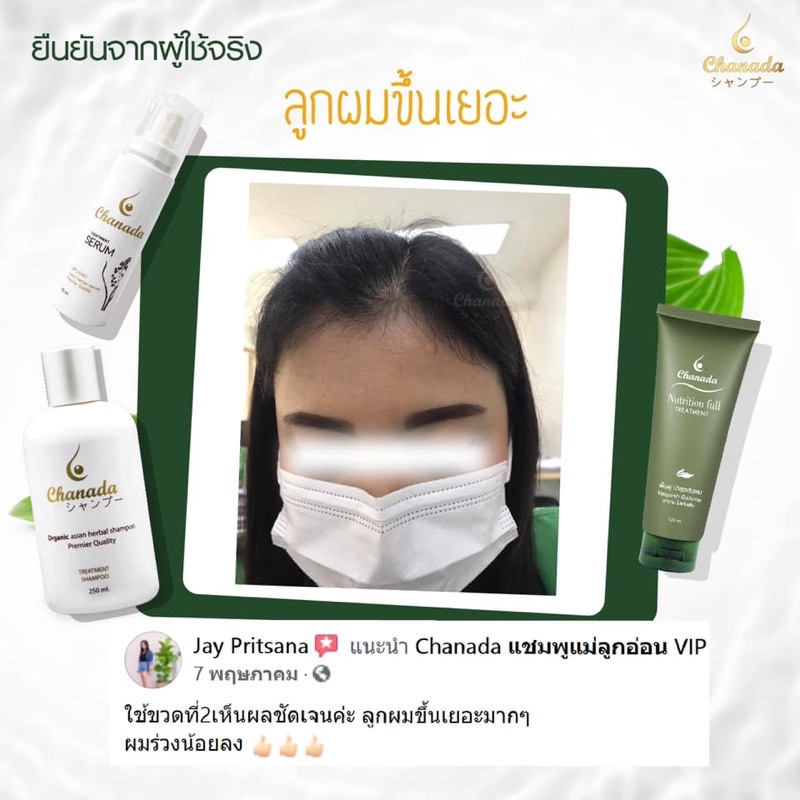 Chanada ️เซรั่มลดผมร่วง ️กระตุ้นผมงอกใหม่ เร่งผมยาว x2 ส่งฟรีมีของแถม ...