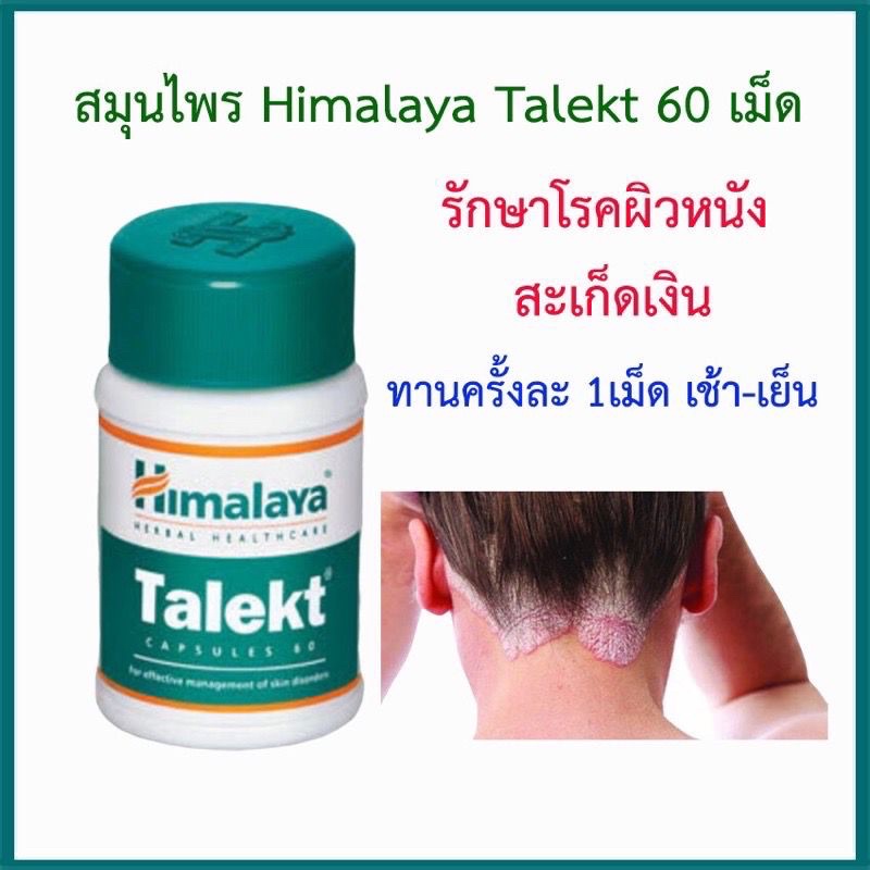 himalaya talekt ผื่น ภูมิแพ้ ผิวหนัง สะเก็ดเงิน - himalaya.sanu - ThaiPick