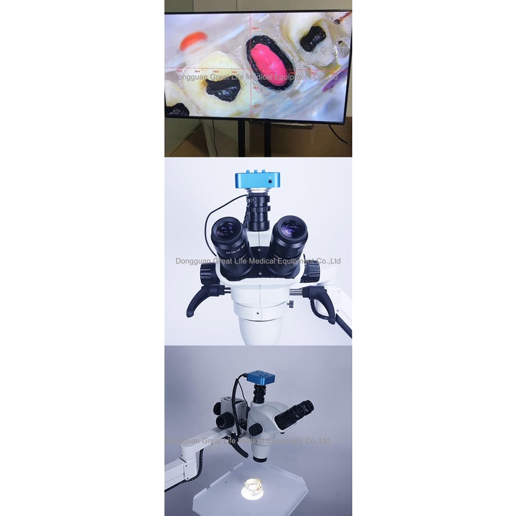 Dental Lab Equipment Hd Surgical Operation Root Canal Treatment Digital ...