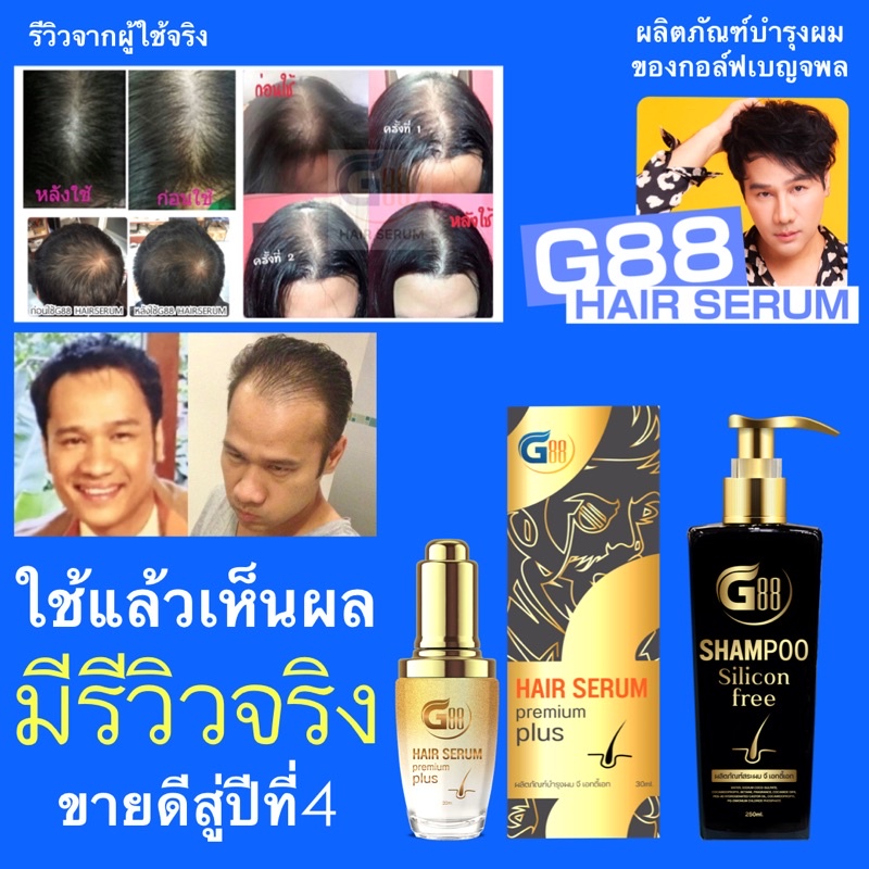 ปลูกผม ลดร่วง G88 Hair Serum จีแปดแปด แฮร์เซรั่ม 30ml #ของแท้ เซรั่มบำรุงผม ผลิตภัณฑ์บำรุงผม ...