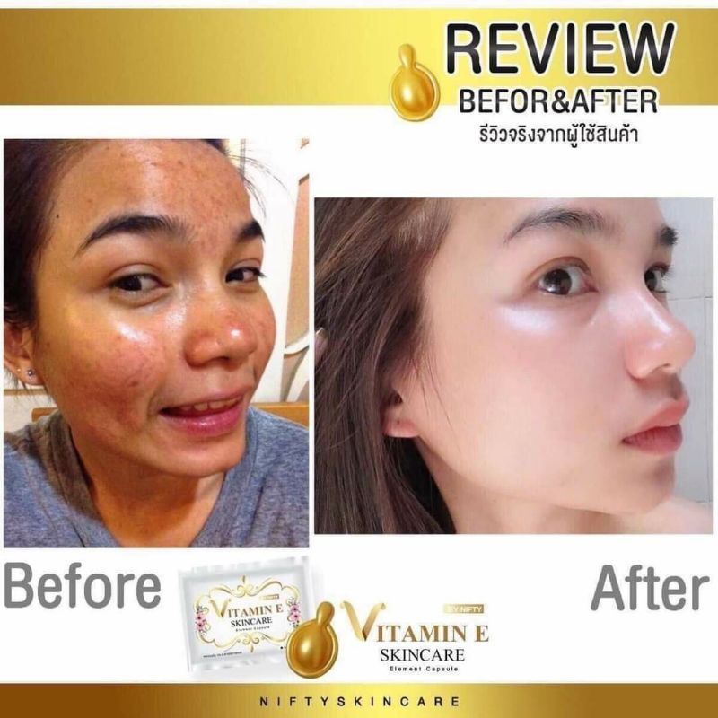 วิตอีหน้าใสvitamin E skincare By Nifti ของแท้100วิตามินอีเข้มข้น บำรุง ...