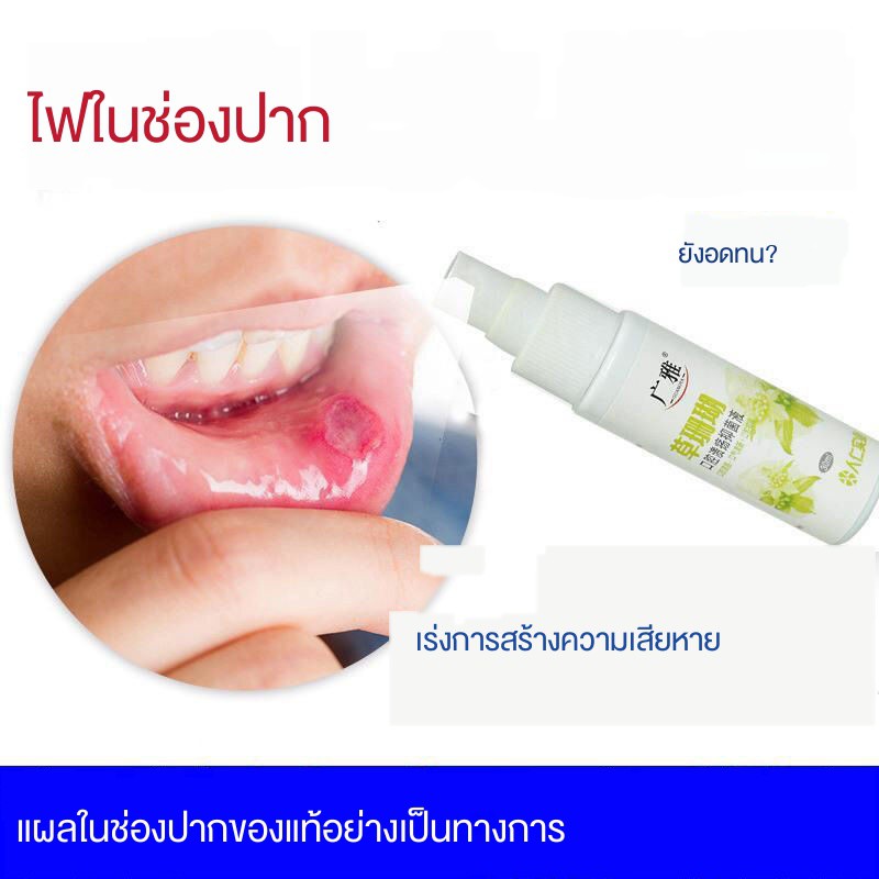 มลัก Coral Oral Spray Sore Mouth Fire Foaming Watermelon Cream Ulcer ...