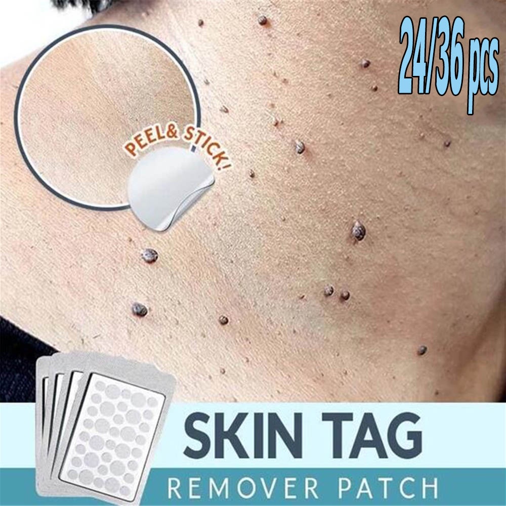 1Bag Skin Tag Remover Patch Ance Pimple Patch Plaster Acne Cream ...