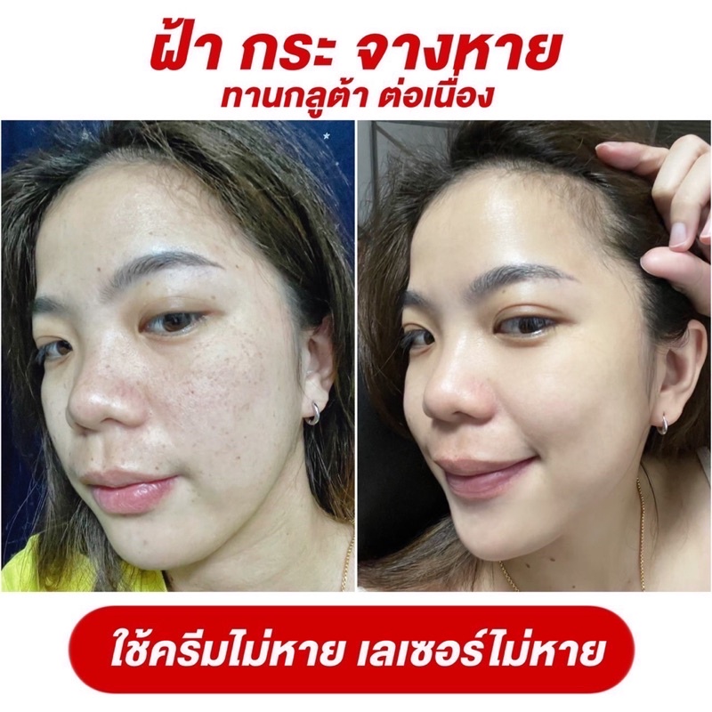 มีของแถมส่งไว️ เซตใหญ่ Bmee กลูต้าคอลลาเจน - bmeesociety - ThaiPick