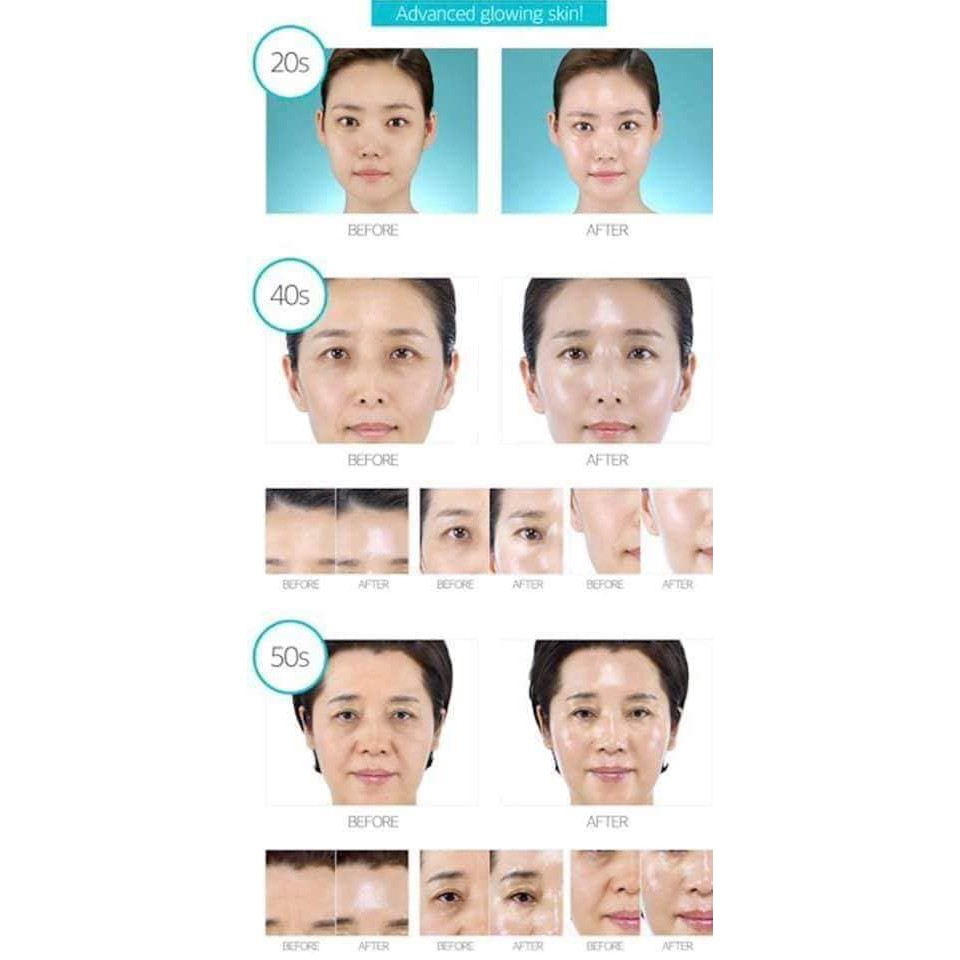 อ่านก่อนสั่ง Wellage Real Hyaluronic Bio Capsule Collagen Gold Vital ...