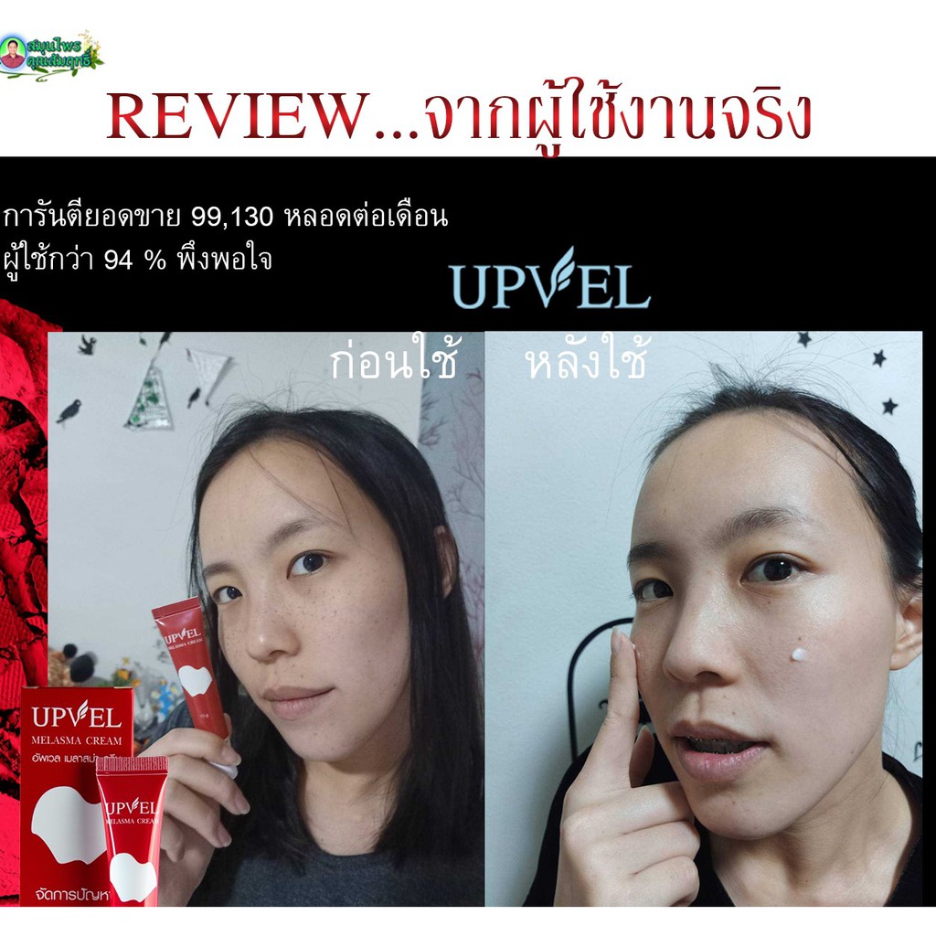 UPVEL Melasma ครีมกำจัดฝ้า - upvel_official - ThaiPick