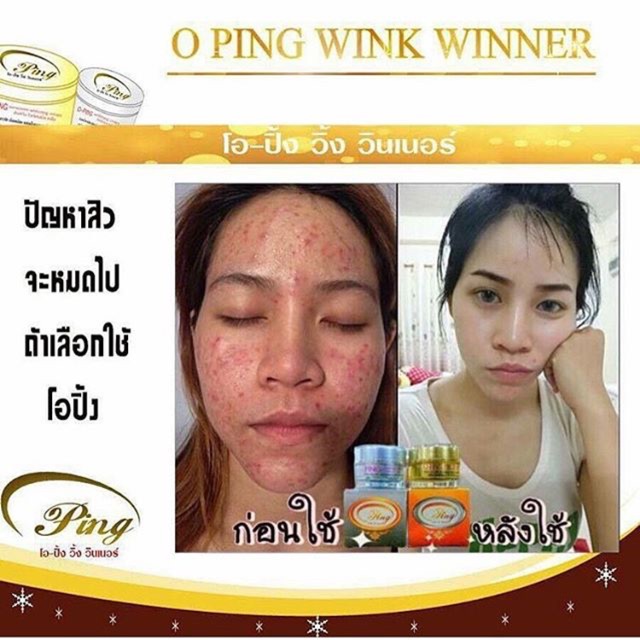 oping ถูกที่สุด พร้อมโปรโมชั่น ต.ค. 2025 | BigGoเช็คราคาง่ายๆ