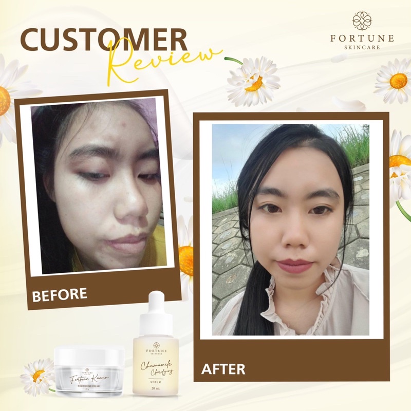เซรั่มคาร์โมมายด์ลดสิวส่งฟรี - thebestskincare.99 - ThaiPick