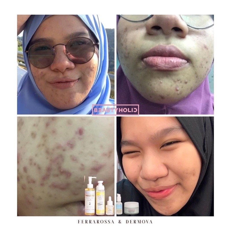 ️ORIGINAL HQ ️ FERRAROSSA COMBO RAYA MAKEUP MELTER MOISTURIZER ...