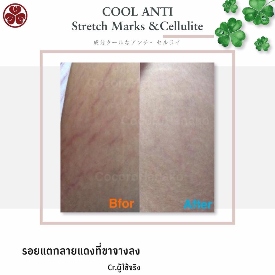 ของแถมฟรี 4 ชิ้น Cocoro Hanako Tokyo Cool Anti Cellulite Cool Collagen ...