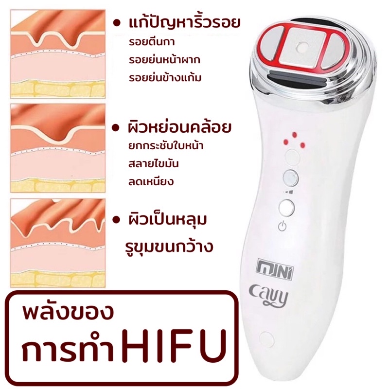 Mini HIFU x Cavy แท้ 100 ประกัน 1 ปี เครื่องไฮฟูยกกระชับ ลดเหนียง ลด ...