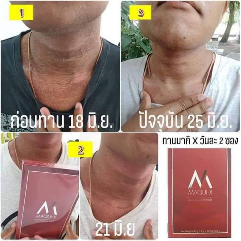 [ที่สุดของการต้านอนุมูลอิสระ] MAQUI-X มากิเอ็กซ์ อร่อย ทานง่าย สกัดจาก ...