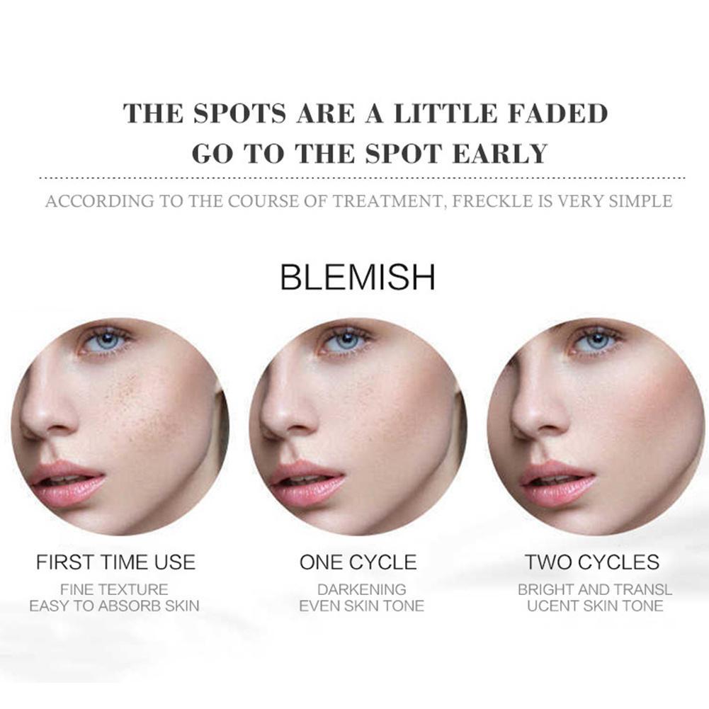 Ai Chun Aichun ครีมบํารุงผิวหน้าต่อต้านริ้วรอยสําหรับผู้ชายและผู้หญิง ...