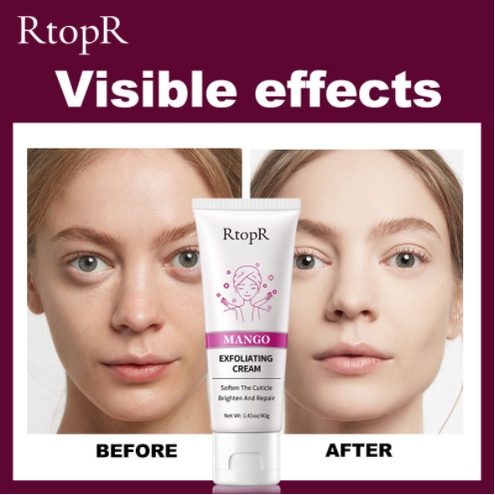 Glolift Serum RtopR แพ็คคู่ ครีมขัดหน้ามะม่วง ขัดหน้า พร้อมเซรั่มบำรุง ...