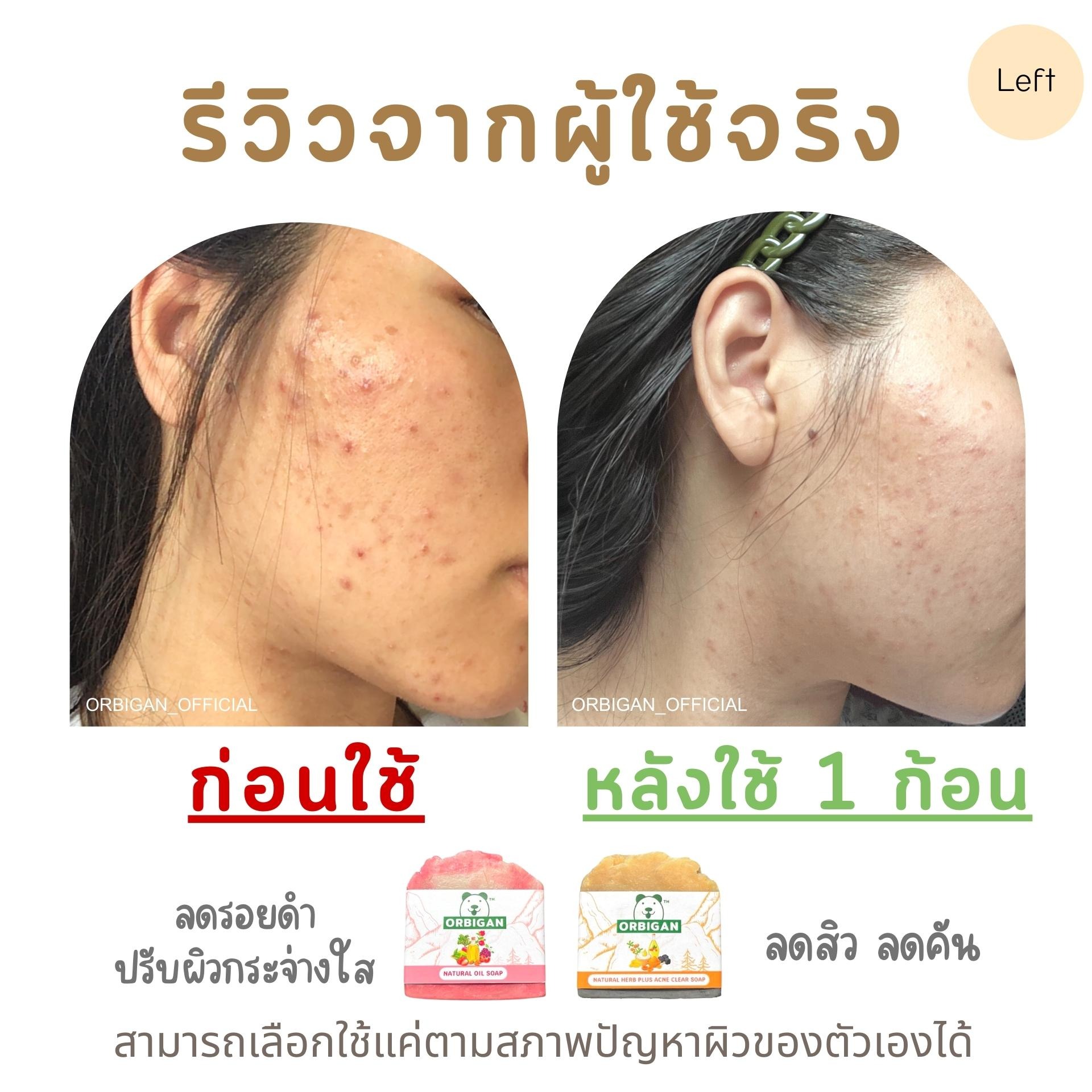 ORBIGAN, ร้านค้าออนไลน์ | Shopee Thailand
