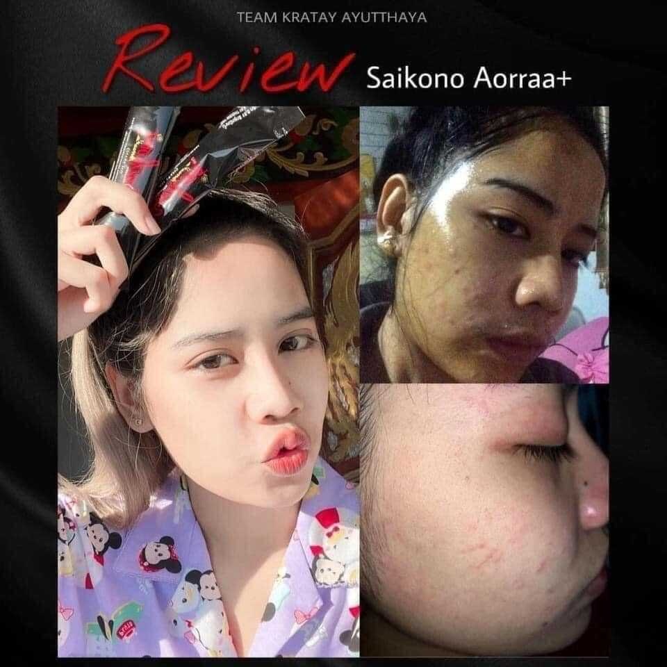 โปร3วันเท่านั้น (ของแท้- พร้อมส่ง) SAIKONO COLLAGEN ไซโกโนะ คอลลาเจน บำรุง ผิวกระจ่างใส บำรุงผม ...