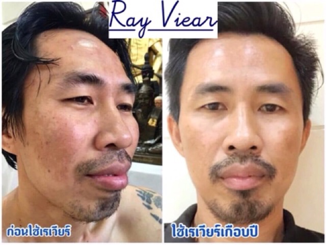 โค้ดส่วนลด 5 Ray Viear Placenta Night Cream ครีมเรเวียร์ ครีมบำรุงสกัด ...