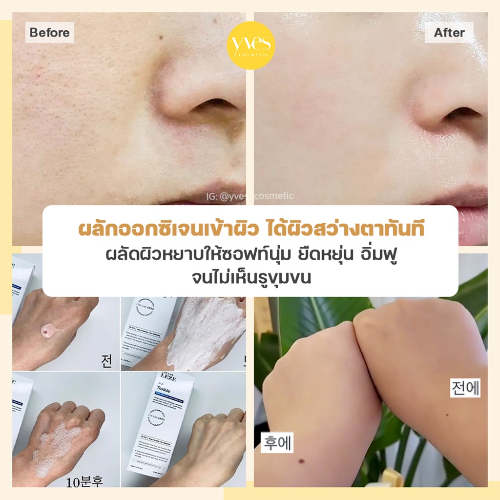 พร้อมส่งด่วน ส่งฟรี SET LEZE Toxble Pores Mask 100ml ILDONG Firstlab ...
