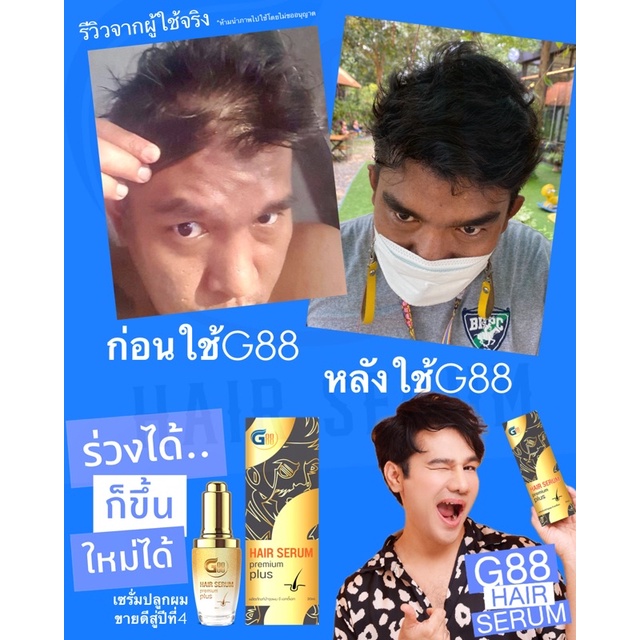 ปลูกผม ลดร่วง G88 Hair Serum จีแปดแปด แฮร์เซรั่ม 30ml #ของแท้ เซรั่มบำรุงผม ผลิตภัณฑ์บำรุงผม ...