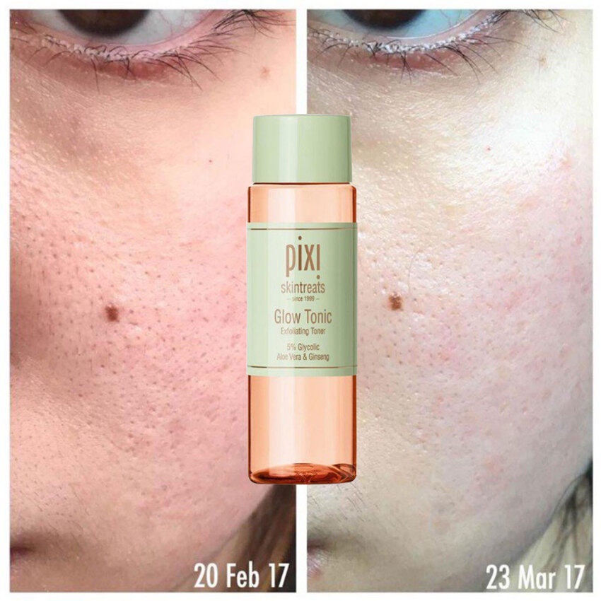 Pixi 100ML 5 Glycolic Acid Glow Tonic Moisturizing Oil-Controlling ...