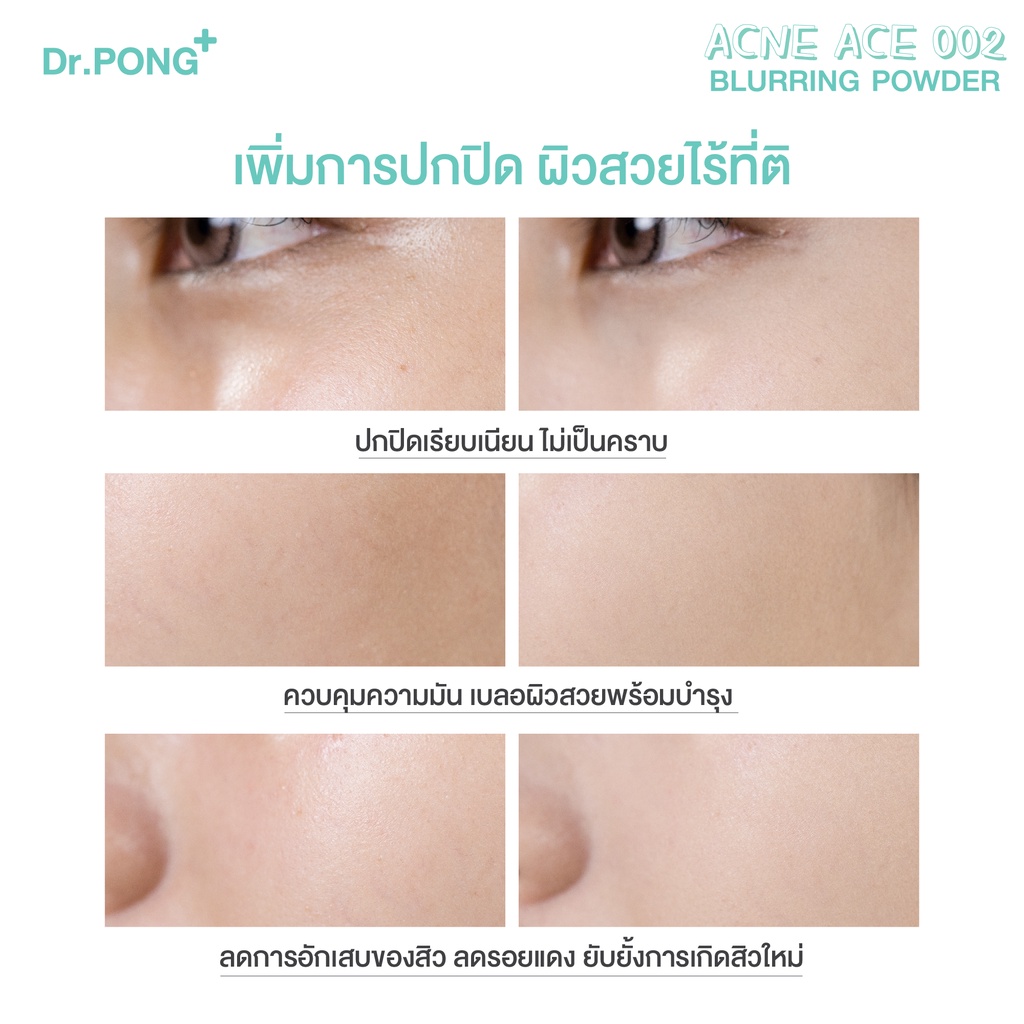 Dr.PONG ACNE ACE 002 แป้งผสมรองพื้น สูตรลดสิว - ZincPCA - Niacinamide ...