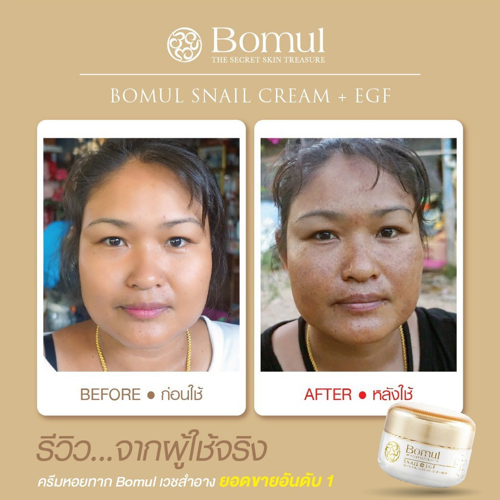ขายดีมาก แนะนำ Bomul Snail Cream+EGF ครีมโบมุล ครีมบำรุงผิว ช่วยให้ฝ้า ...
