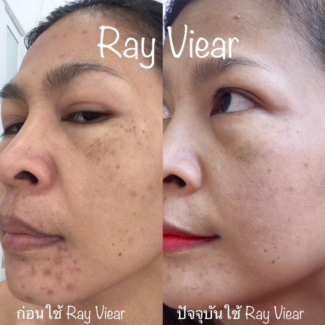 Ray viear Perfect Ampoules (Day cream) ครีมเรเวียร์ เซรั่มบำรุงผิวหน้า ...