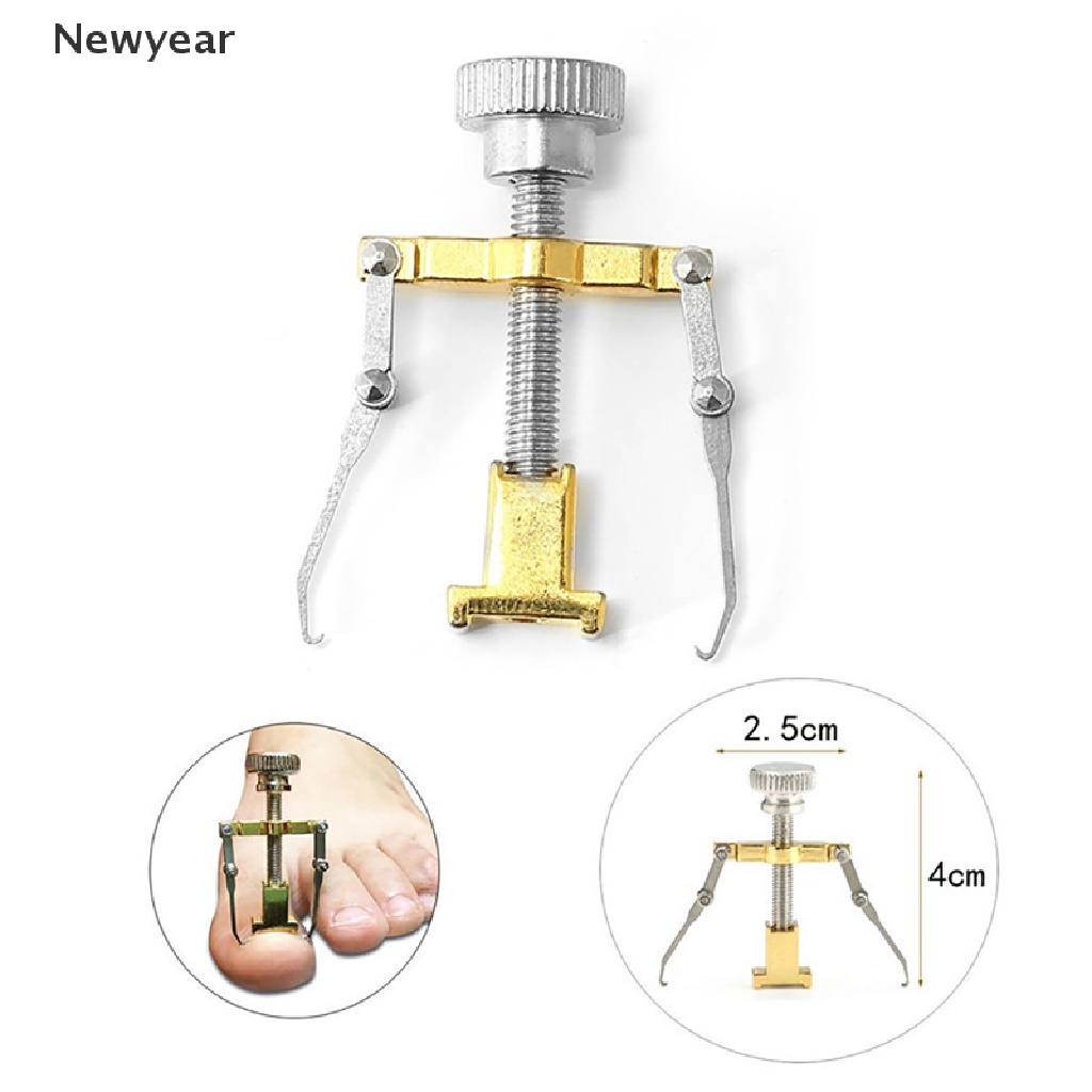 Newyear Ingrown Toenail Correction Tool Foot Toe Nail Care Clip Brace ...