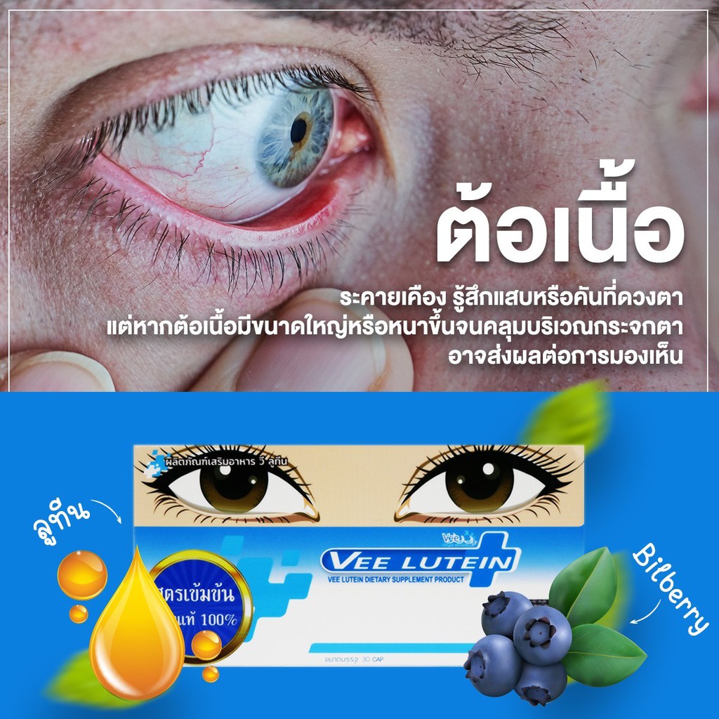 แพคเกจใหม่! Vee Eye Lutein วีอายลูทีน อาหารเสริมบำรุงสายตา สูตรลูทีน ...