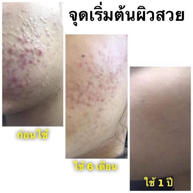 Ray viear Plant Placenta Night Cream à¸„à¸£à¸µà¸¡à¸šà¸³à¸£à¸¸à¸‡à¸œà¸´à ...
