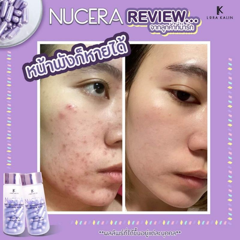 Nucera วิตามินผิวโกลว์ของแท้ (ส่งฟรี) - nucera_glow_skin - ThaiPick