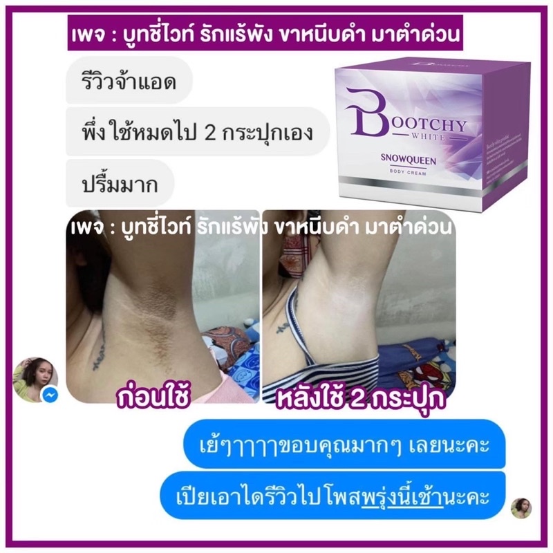 (มีของแถม)ครีมบูชชี่ของแท้ 100 มีบัตรตัวแทน Bootchy white บูชชี่ไวท์ รักแร้ดำ รอยแตกลาย ขาหนีบดำ ...