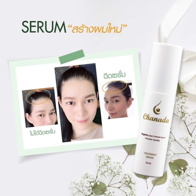 Chanada ️เซรั่มลดผมร่วง ️กระตุ้นผมงอกใหม่ เร่งผมยาว x2 ส่งฟรีมีของแถม ...