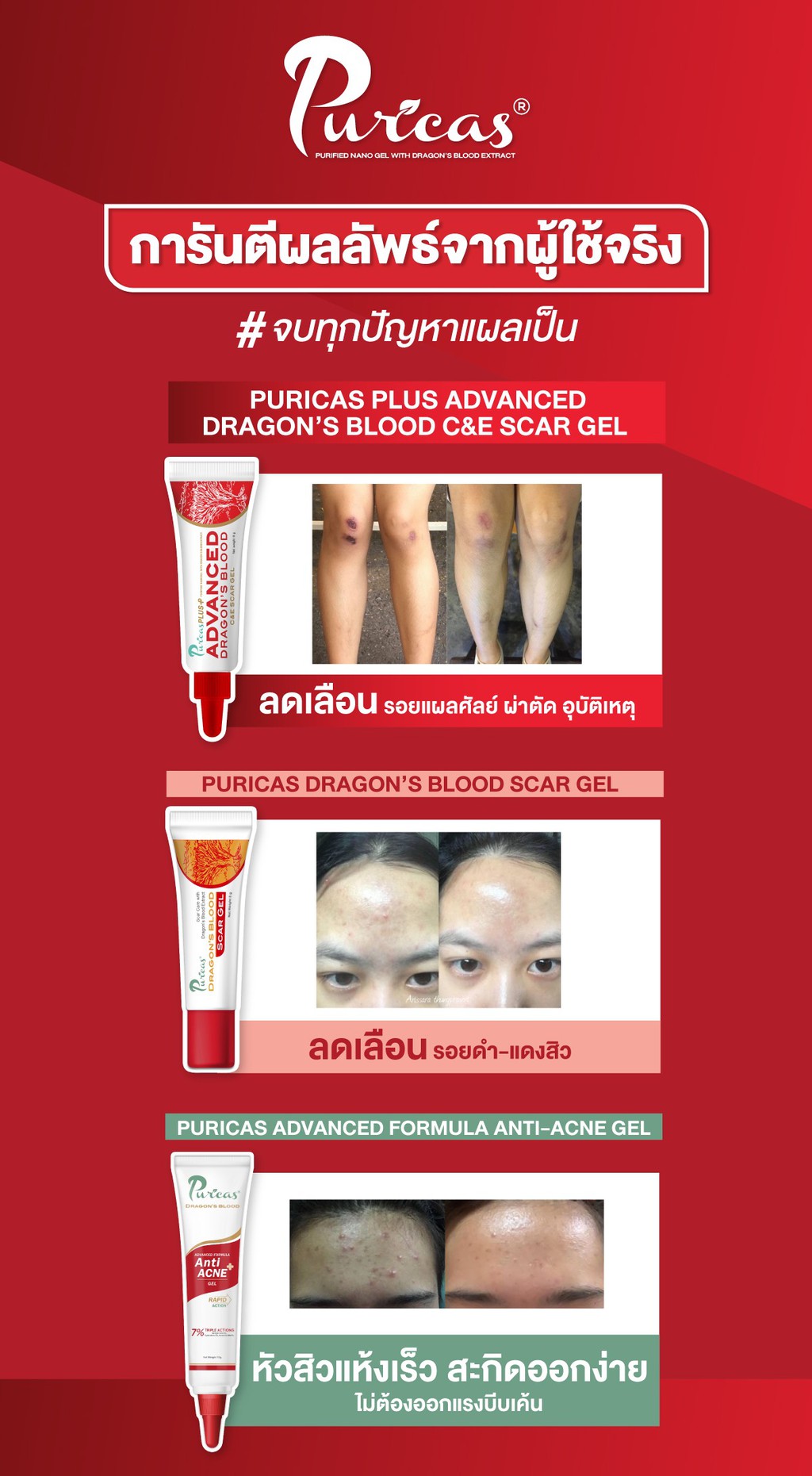 Puricas official shop, ร้านค้าออนไลน์ | Shopee Thailand