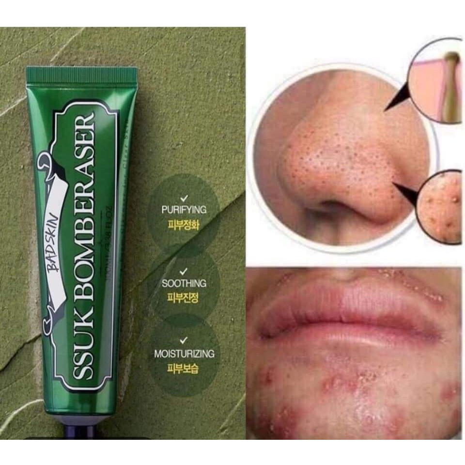 SSUK BOMB ERASER ผลิตภัณฑ์ดูแลผิวหน้านำเข้าจากประเทศเกาหลี ช่วยผลัด ...