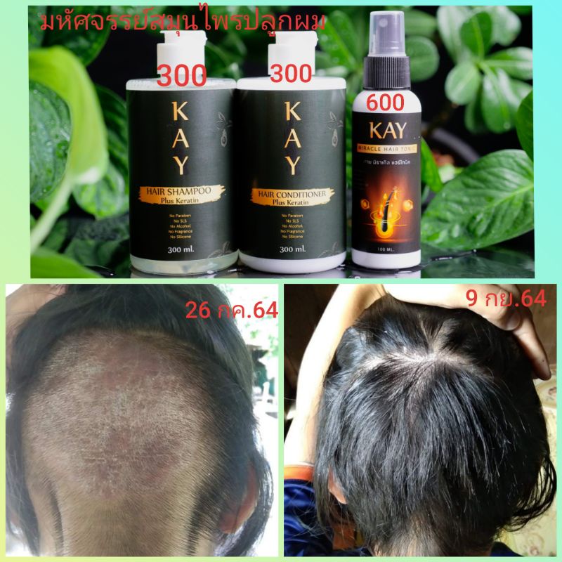 ชุดผม KAY Miracle Hair TonicHair ShampooHair Conditioner มหัศจรรย์ ...