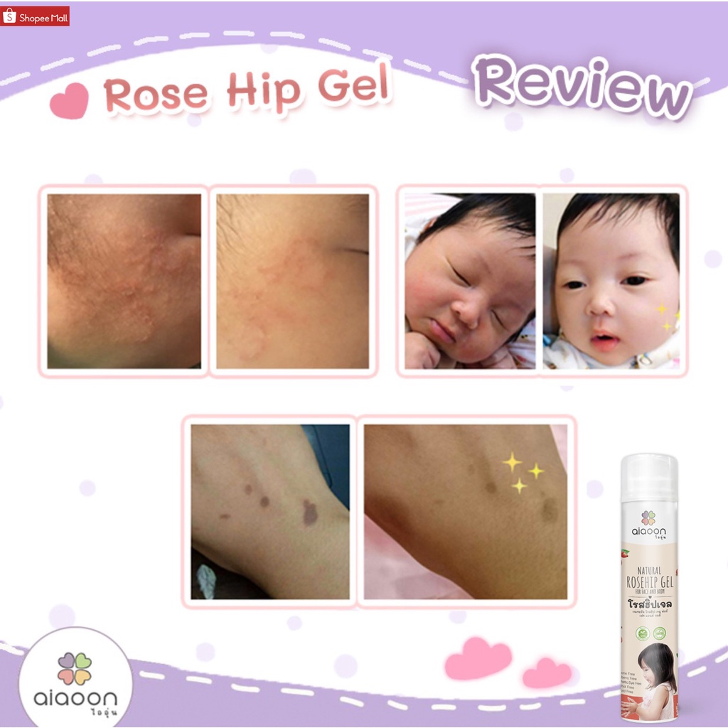 ไออุ่น โรสฮิปเจล บำรุงผิว ลดรอยดำ (aiaoon Natural Rosehip Gel for Face ...