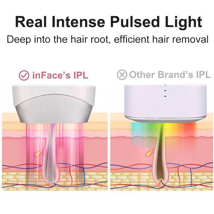 (ของแท้100พร้อมส่งจากรุงเทพ) Xiaomi inFace IPL Crystal Freezing Point ...