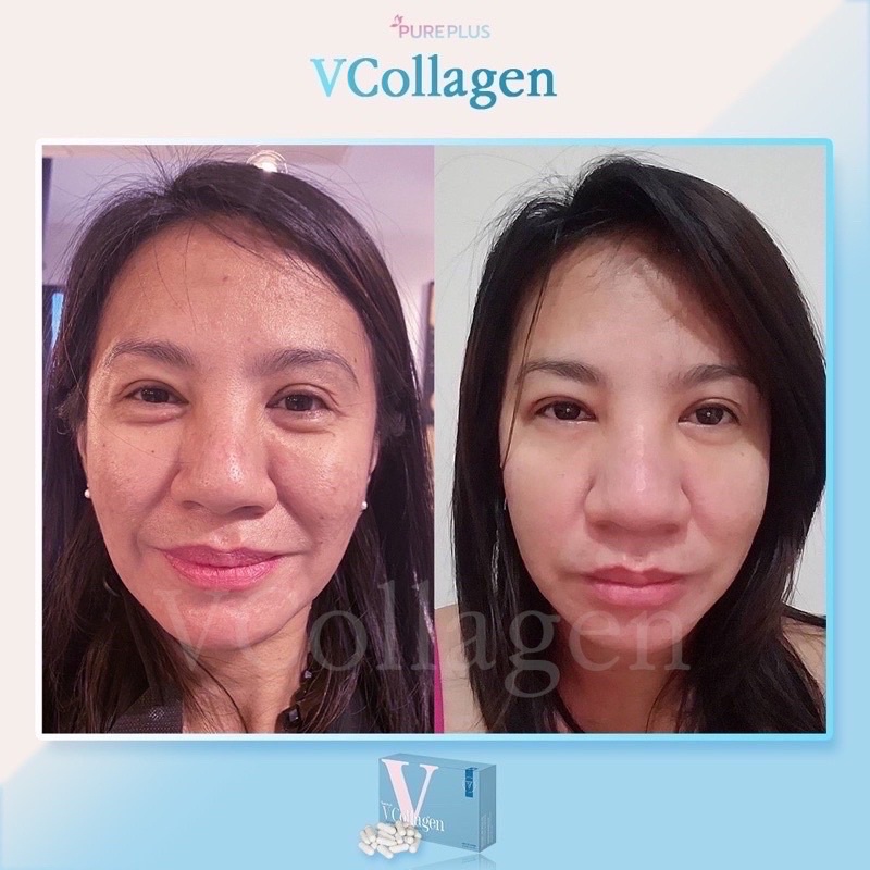 ซื้อ 2 แถม 1ส่งฟรี️ Pureplus V Collagen ลดริ้วรอย ยกกระชับ ซ่อมแซมผิว ผิวกระจ่างใส ต้านอนุมูล ...