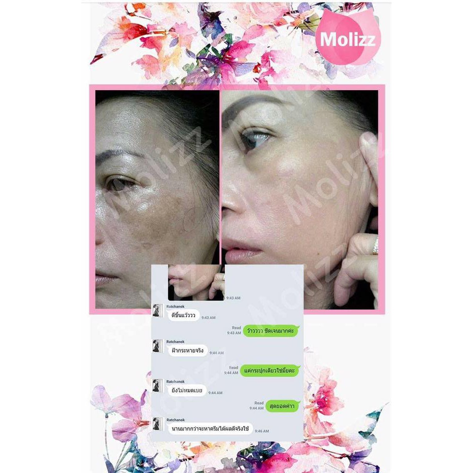 (ของแท้)ครีมทาฝ้า Molizz โมลิส ครีมรักษาฝ้า ขนาด 15 กรัม - prettynarak ...