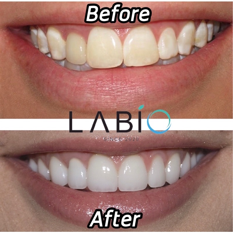 1หลอด Labio Herbal Bright Toothpaste ยาสีฟันสมุนไพร ลาบิโอ้ สารสกัด12 ...
