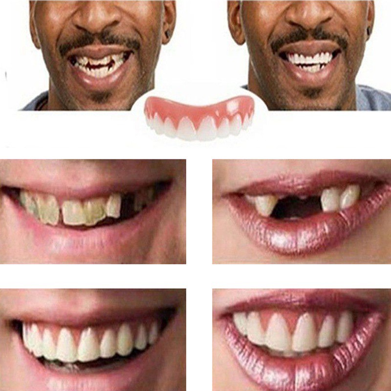 2PC Professional Perfect Smile Veneers Dub Stock Correction Teeth ...