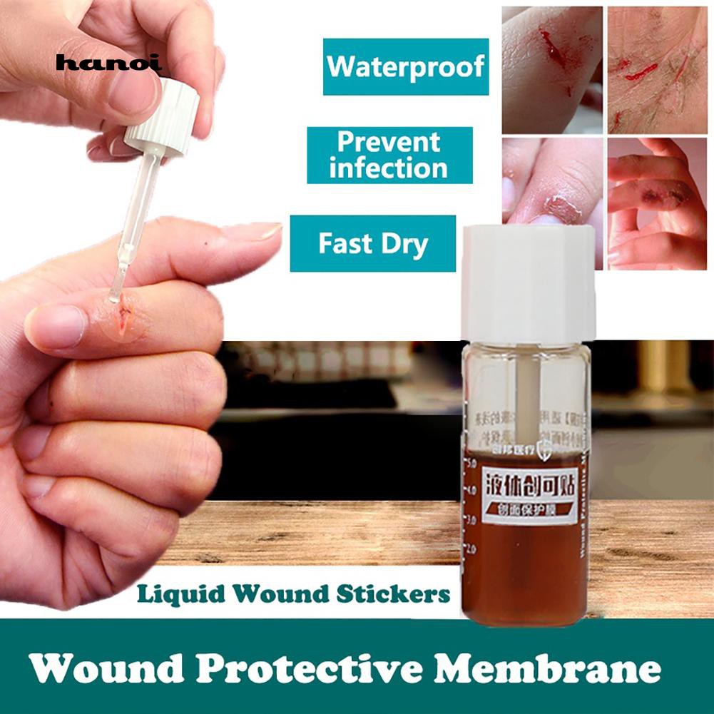 Gentrex cream ทาแผลสด ไม่แสบ ฆ่าเชื้อ ป้องกันแบคทีเรีย - young_pink ...