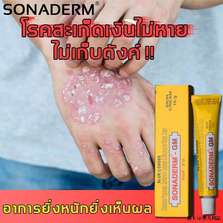 Sonaderm ถูกที่สุด พร้อมโปรโมชั่น - ธ.ค. 2021 | BigGo เช็คราคาง่ายๆ