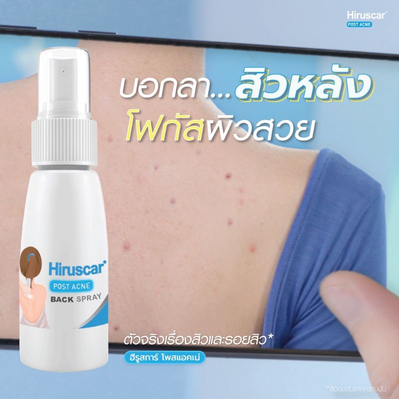 (((สเปรย์สิวหลัง)))Hiruscar Post Acne Back Spray 50Ml ฮีรูสการ์ โพสต์ ...