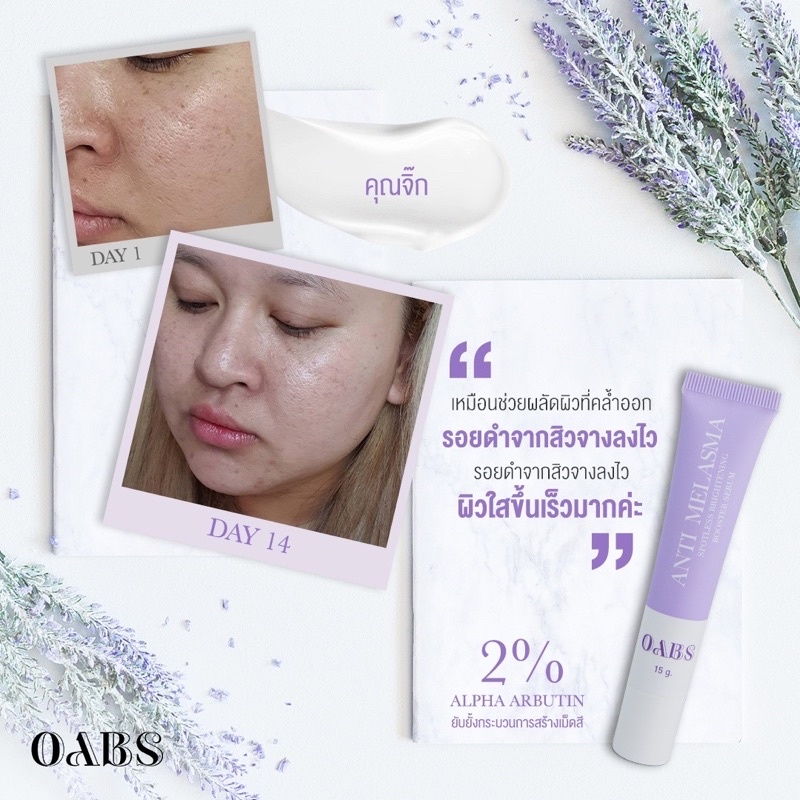 ซื้อ 2 แถม 1 OABS Anti-Melasma Spotless Brightening Booster Serum ...