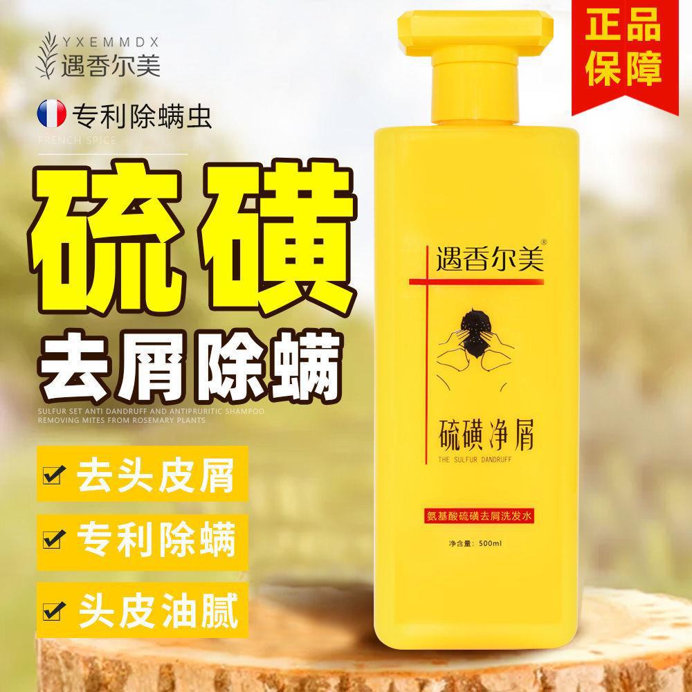 Amino Acid Sulfur Anti-Mite Shampoo Mite-Removal Anti-Dandruf and Relieve Itching Oil Control ...