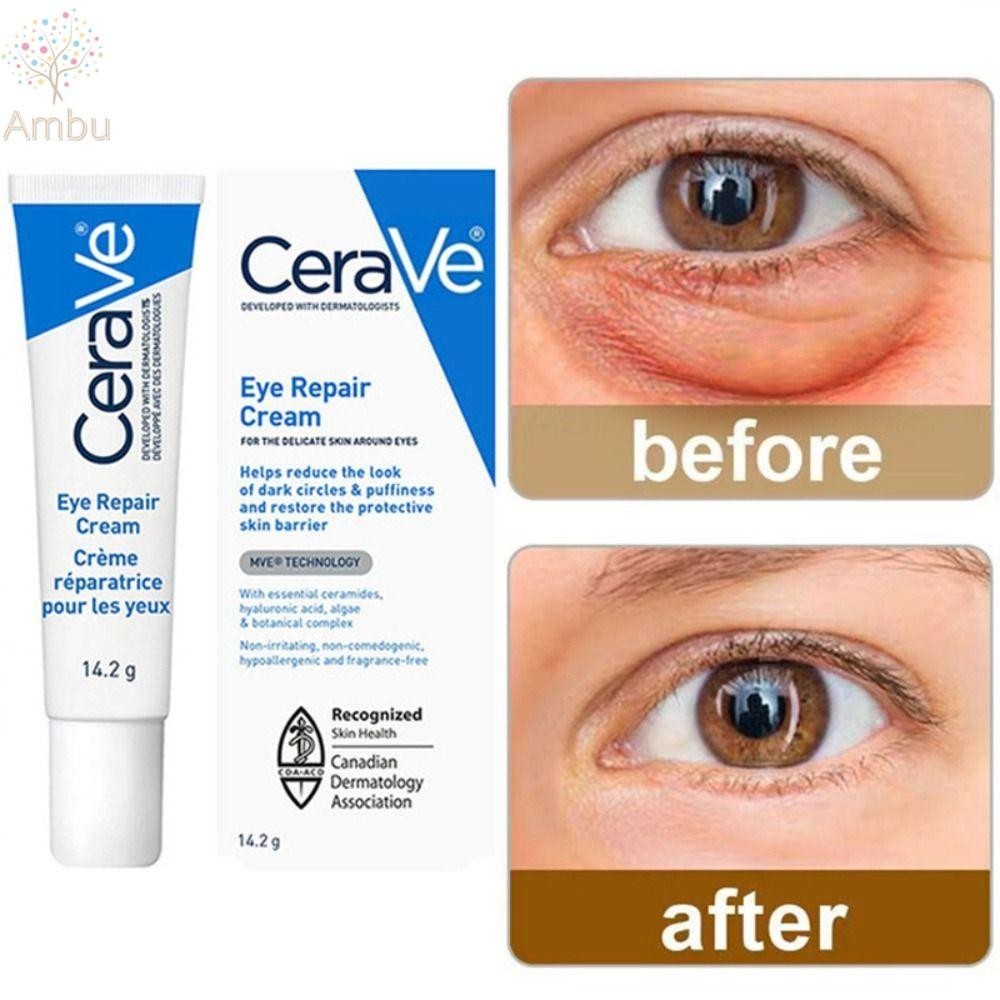 Ambu Eye Repair Cream, Anti-Wrinkle Eye Skin Care, Repair Skin Barrier ...