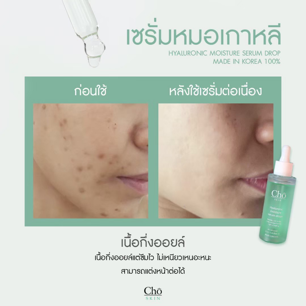 CHO SKIN HYALURONIC MOISTURE SERUM DROPS เซรั่มไฮยาหมอเกาหลี ขนาด 50 ml ...